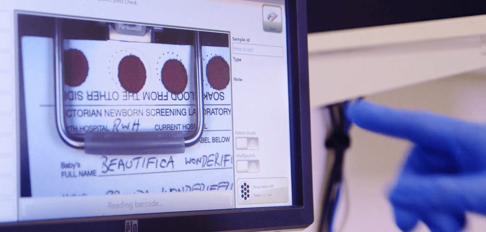 Newborn bloodspot screening
